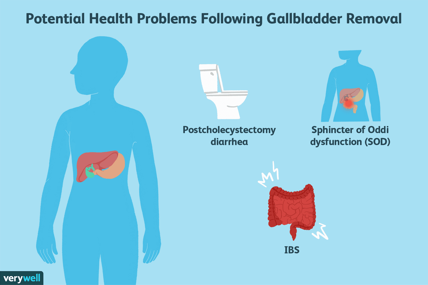 Gallbladder Pain Location Diagram Exatin info